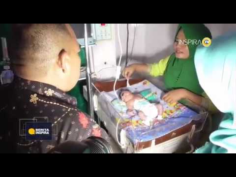 Heboh Bayi Lahir dengan satu Mata tanpa Hidung