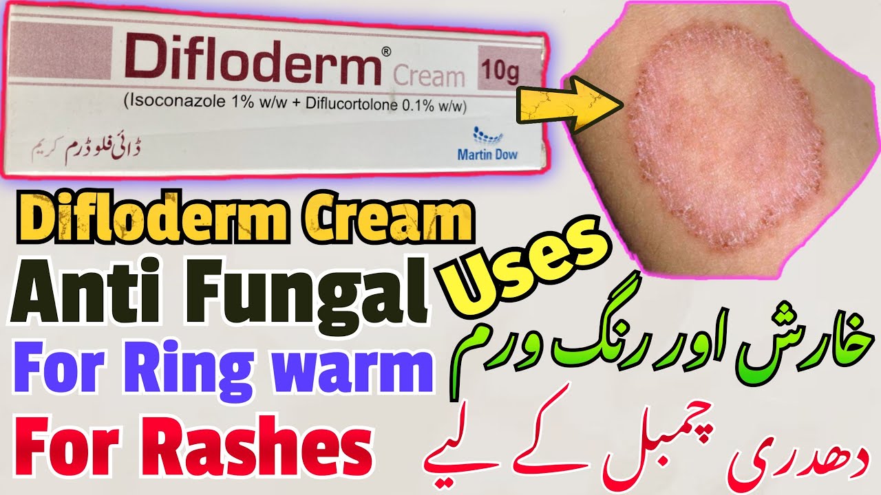 Difloderm Cream || Uses || Benefits || Martin Dow @ChMedicinePoint ...