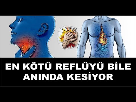 Mide yanmasını geçiren etkili ve doğal tavsiyeler!