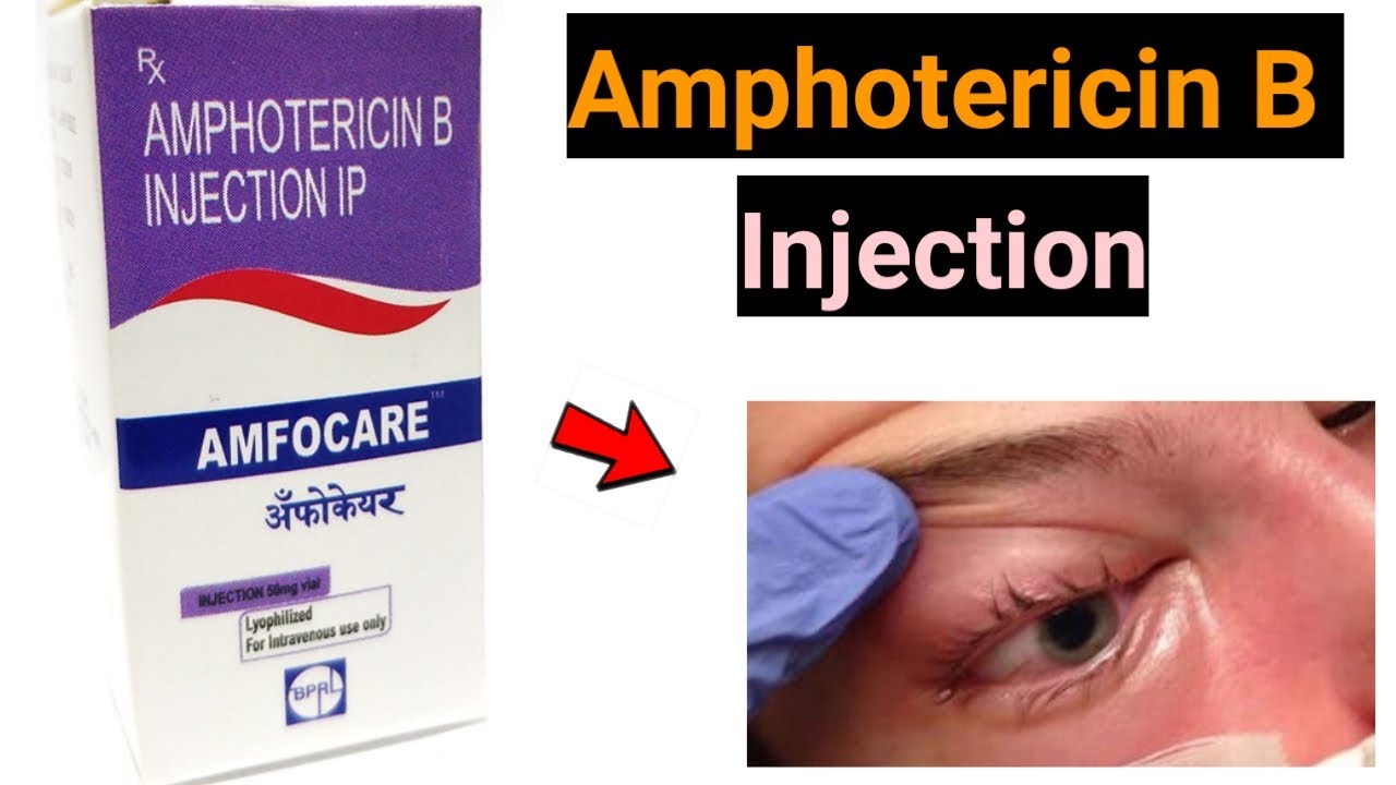 Amphotericin b injection ip 50mg - uses/dosage/side effects/precautions ...