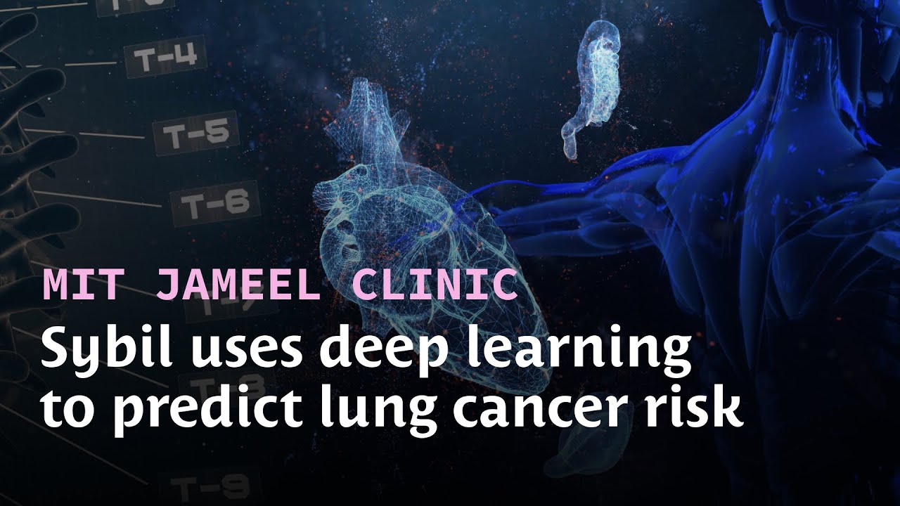 Sybil: Transforming lung cancer prediction with AI - YouTube
