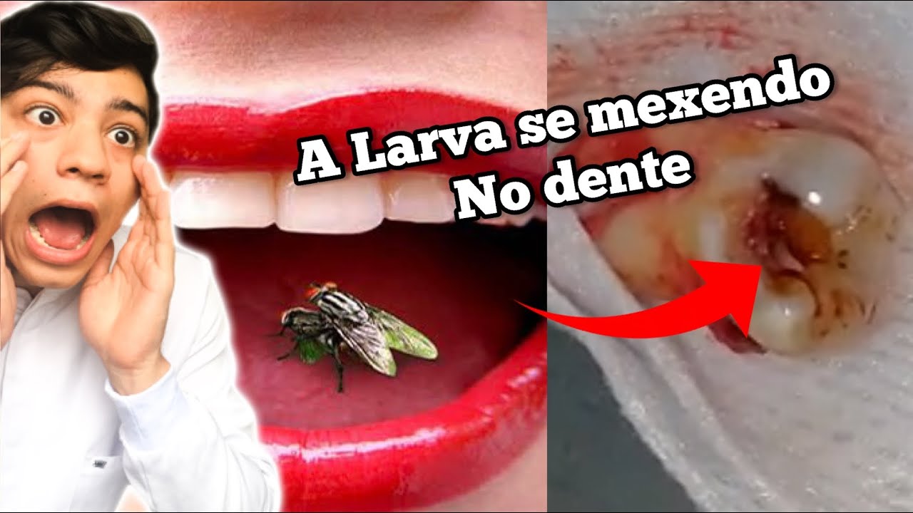 UMA MOSCA ENTROU NA BOCA E ISSO ACONTECEU - YouTube