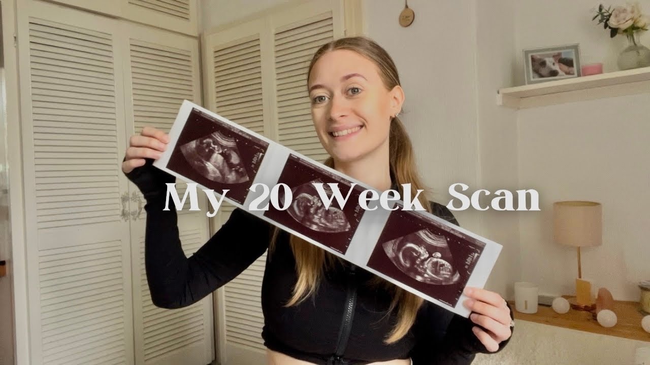 20 week scan - YouTube