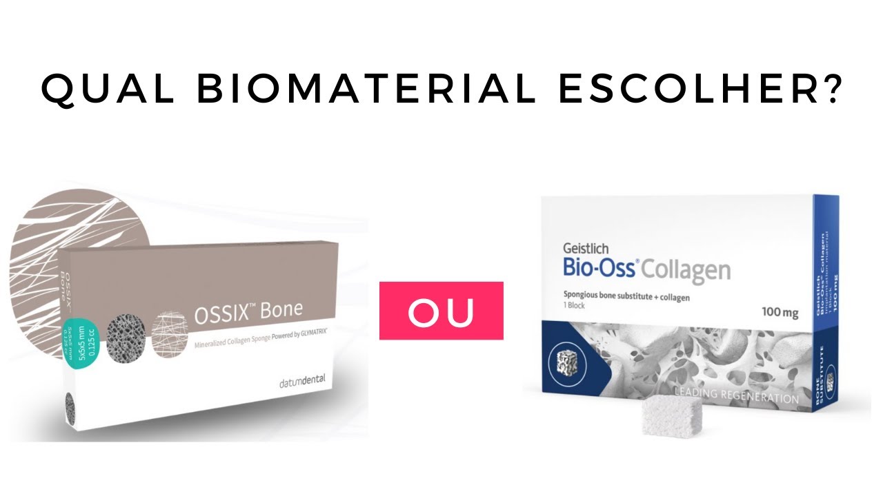 Ossix Bone ou Bio Oss Collagen para preservação alveolar? - YouTube