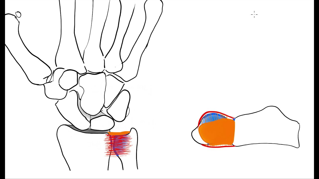 Drawn osteoarticular anatomy of the wrist and hand - YouTube