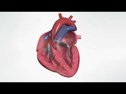 The Normal Heart - YouTube