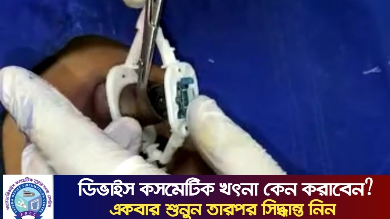 ডিভাইস কসমেটিক সুন্নতে খাৎনা | সুন্নতি খাতনা | মুসলমানী | Circumcision ...