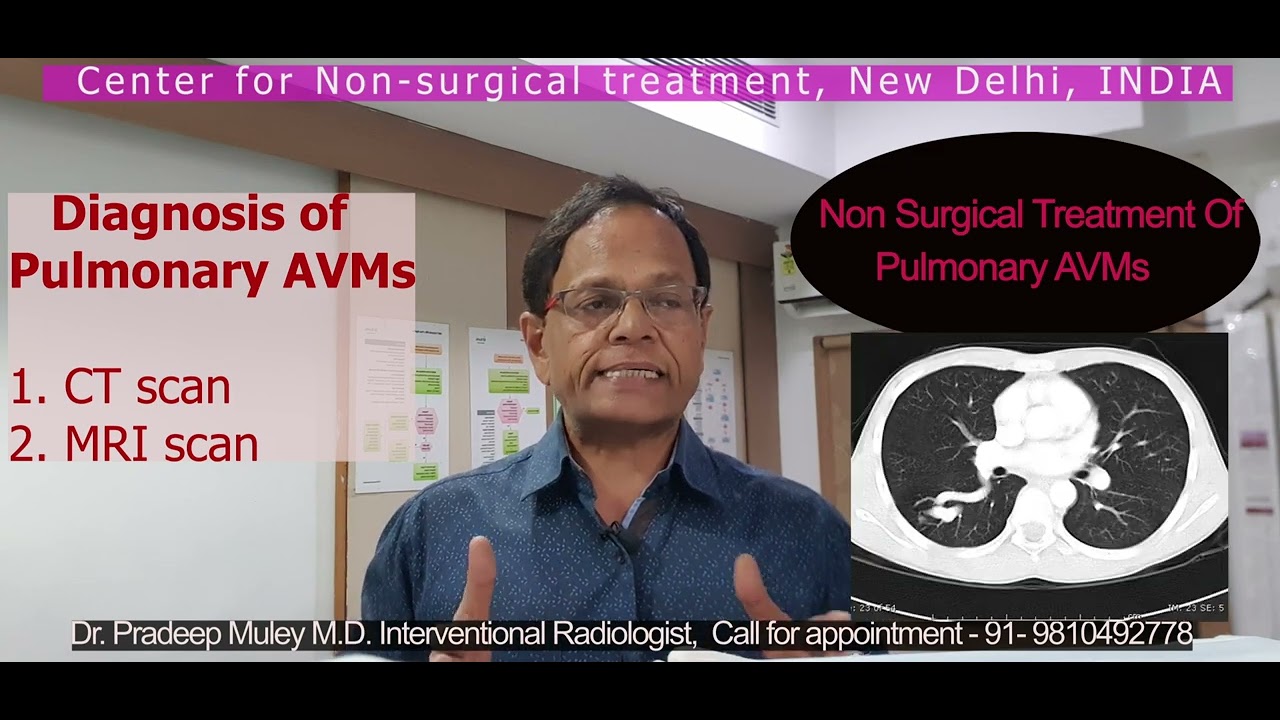 Pulmonary AVMs, Arterio-venous Malformatiion - YouTube