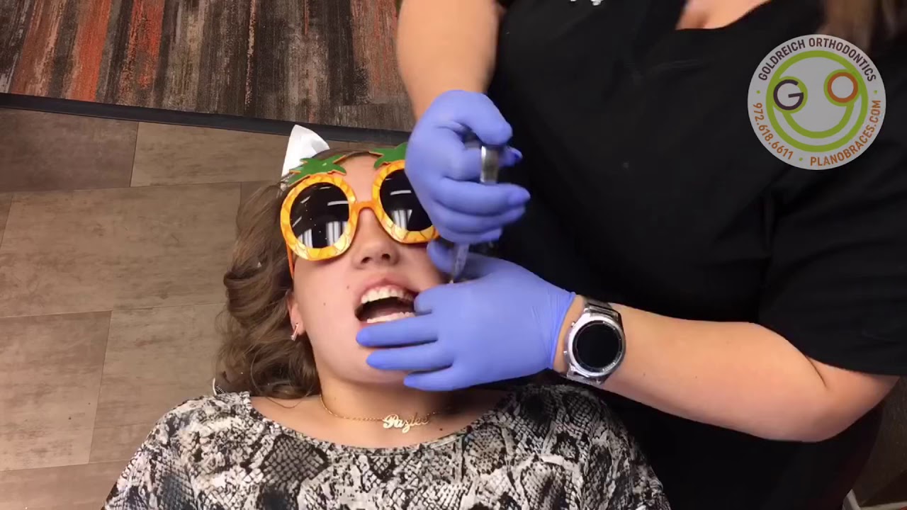 Pazlee Gets Her Braces Off! - YouTube