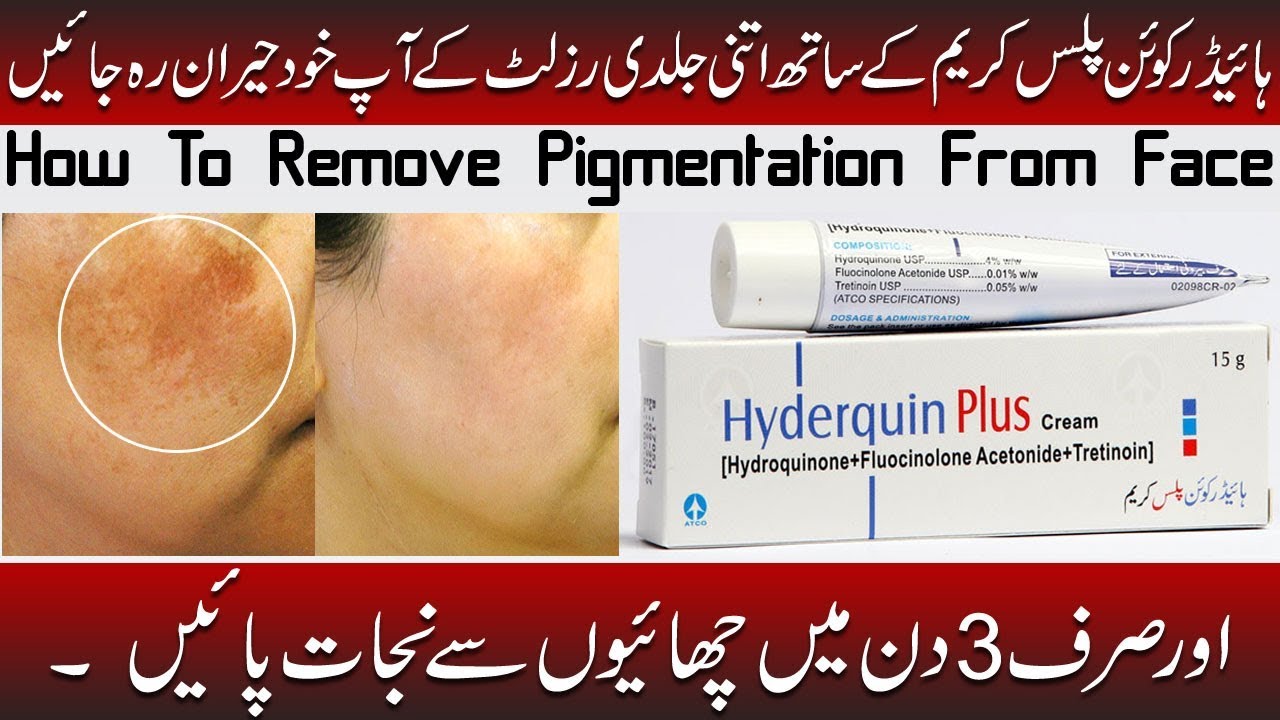 Hyderquin Plus Cream Ke Sath Sirf Teen 3 Din Mein Result - Mahnoor ...