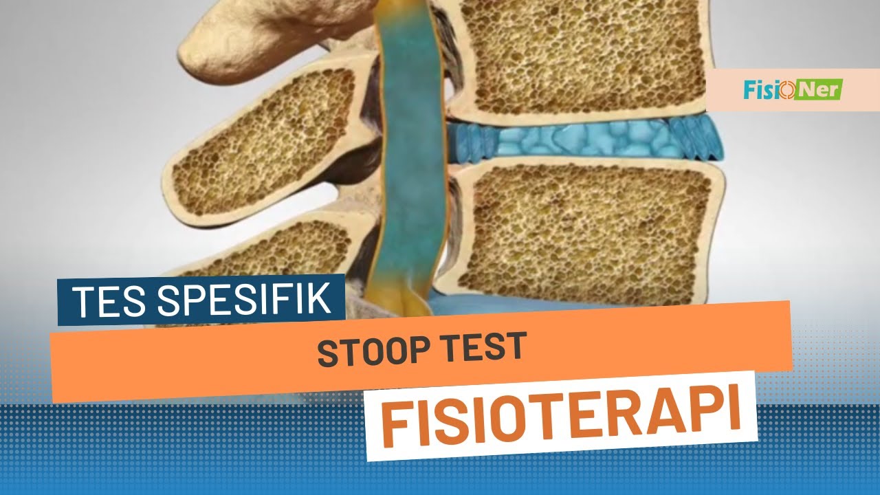 Stoop Test - Klaudikasio Intermiten Neurogenik - YouTube