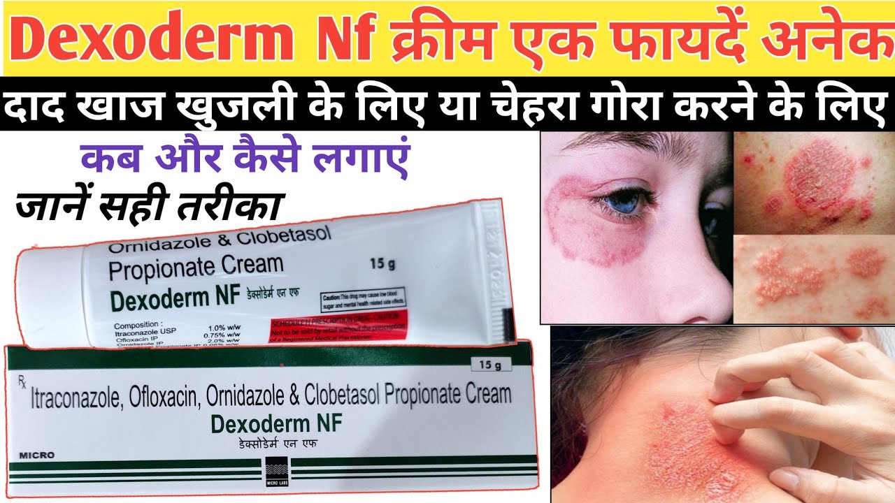 Dexoderm nf | dexoderm nf cream ke fayde | dexoderm oc plus cream ...