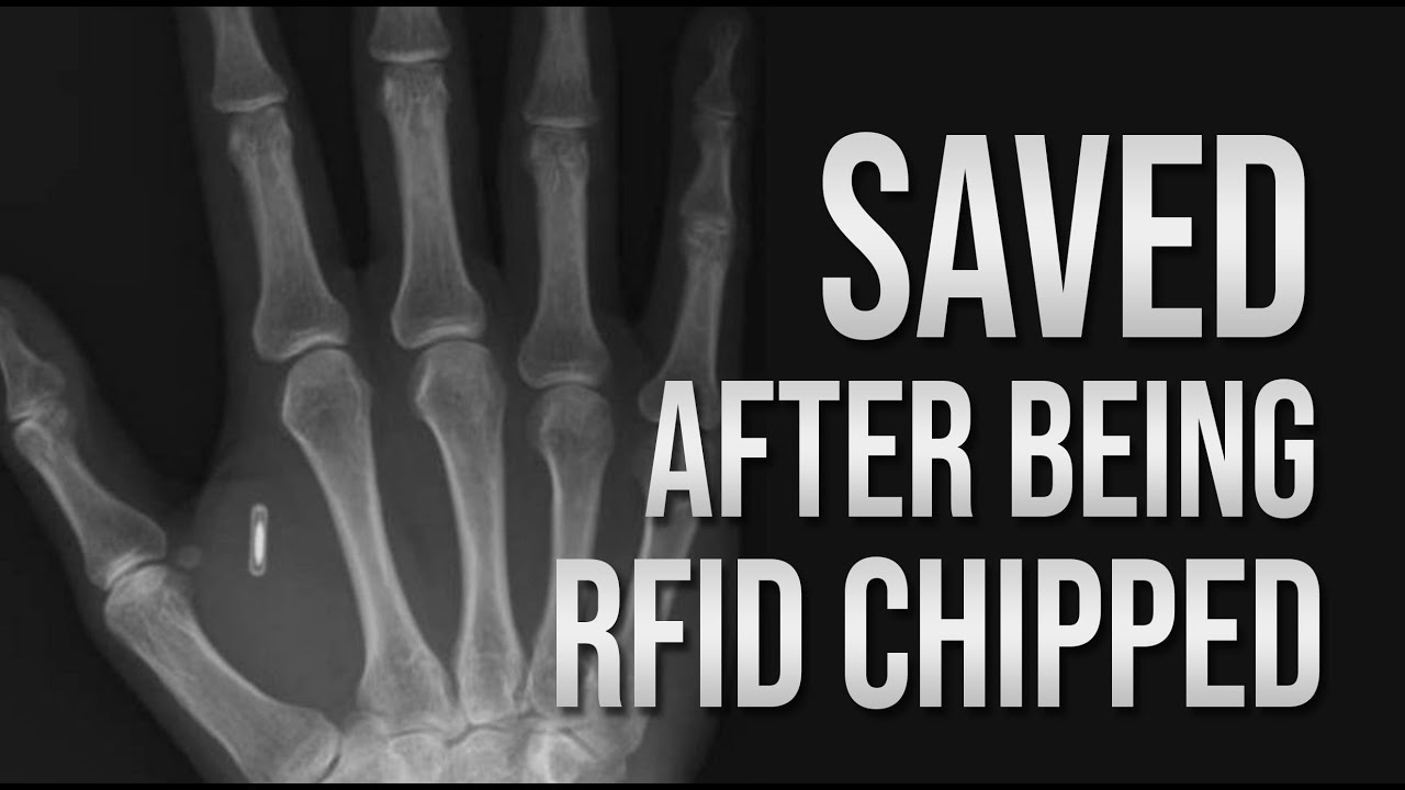 Saved after being chipped (RFID)? - YouTube