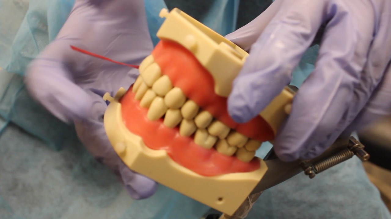 ITR Placement - YouTube