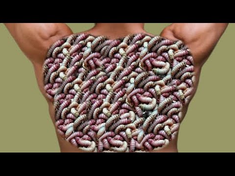 ASMR 2d animation treatment body care. How to removal worms from back ...