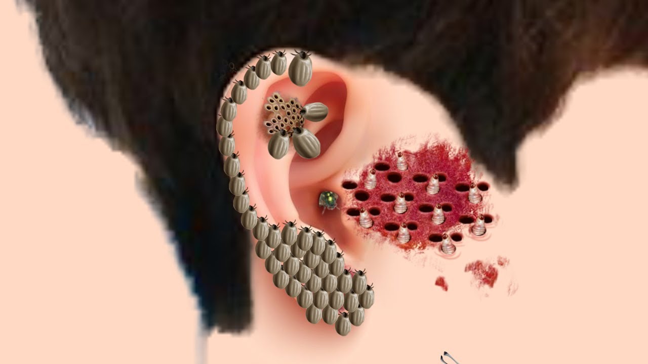 ASMR Treatment 2D Animation | Infected Ears Treatment | @HealAsmr914K ...