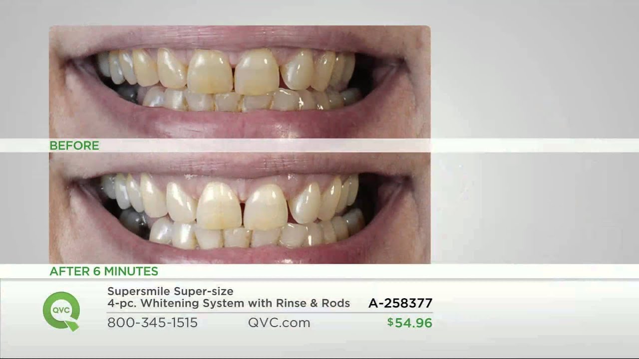 Supersmile Super-size 4 pc Whitening System w/ Rinse & Rods with Rick ...