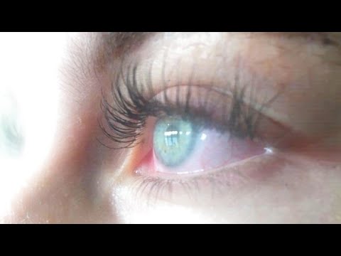 Yem yeşil gözlerim var