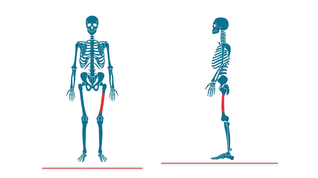Bone study in nuclear medicine - YouTube