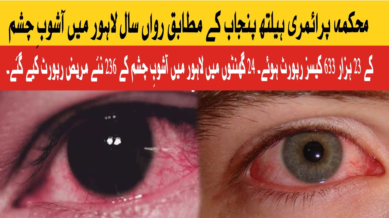 Department Of Primary Health Punjab 23 Thousand 633 Cases Of department-of-primary-health-punjab-23-thousand-633-cases-of