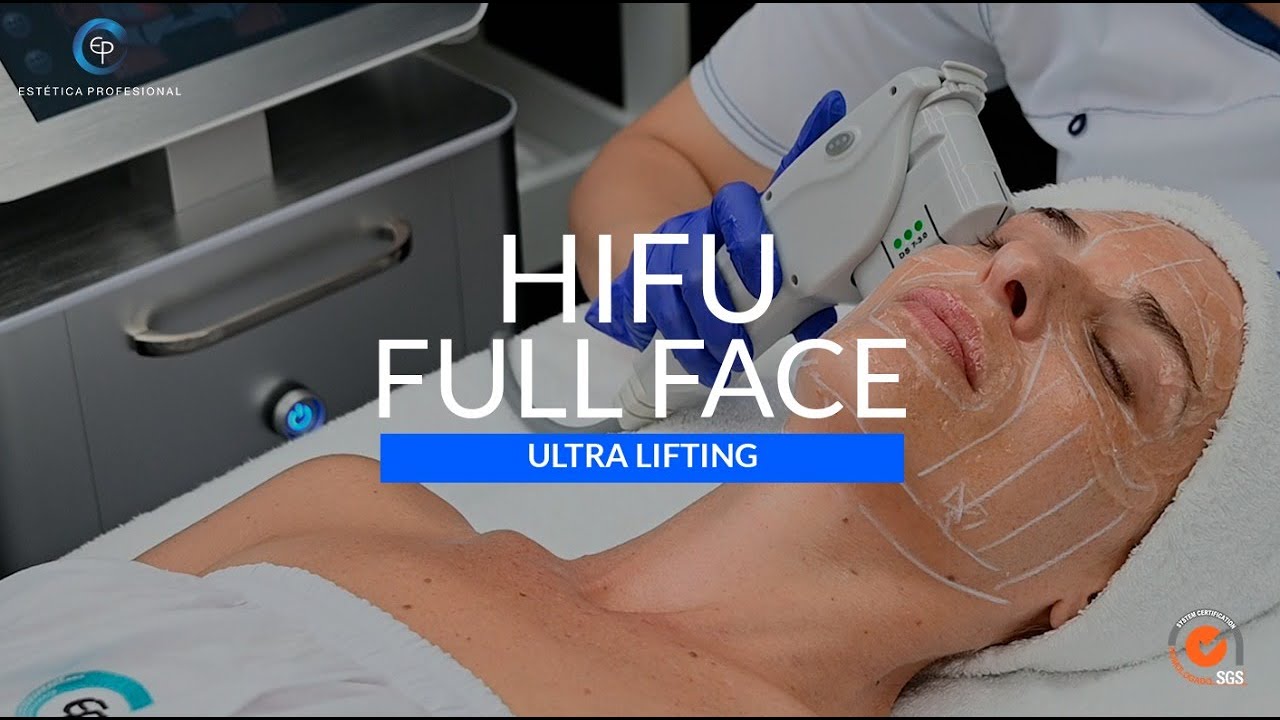 HIFU FULL FACE ULTRA LIFTING | EP ESTÉTICA PROFESIONAL - YouTube