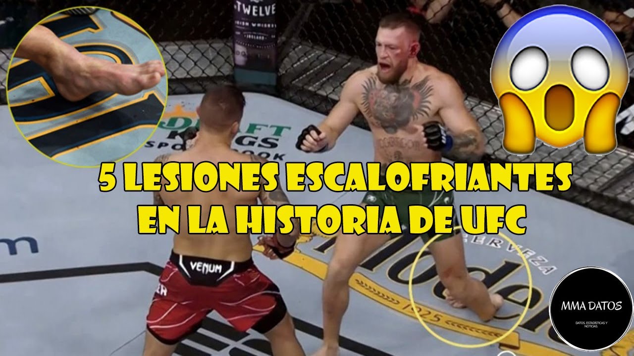5 ESCALOFRIANTES LESIONES EN LA HISTORIA DE UFC | NO SE JUEGA A LAS MMA ...