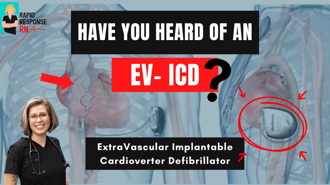 ICDs Explained: Traditional vs S-ICD vs EV-ICD (The Future of ...