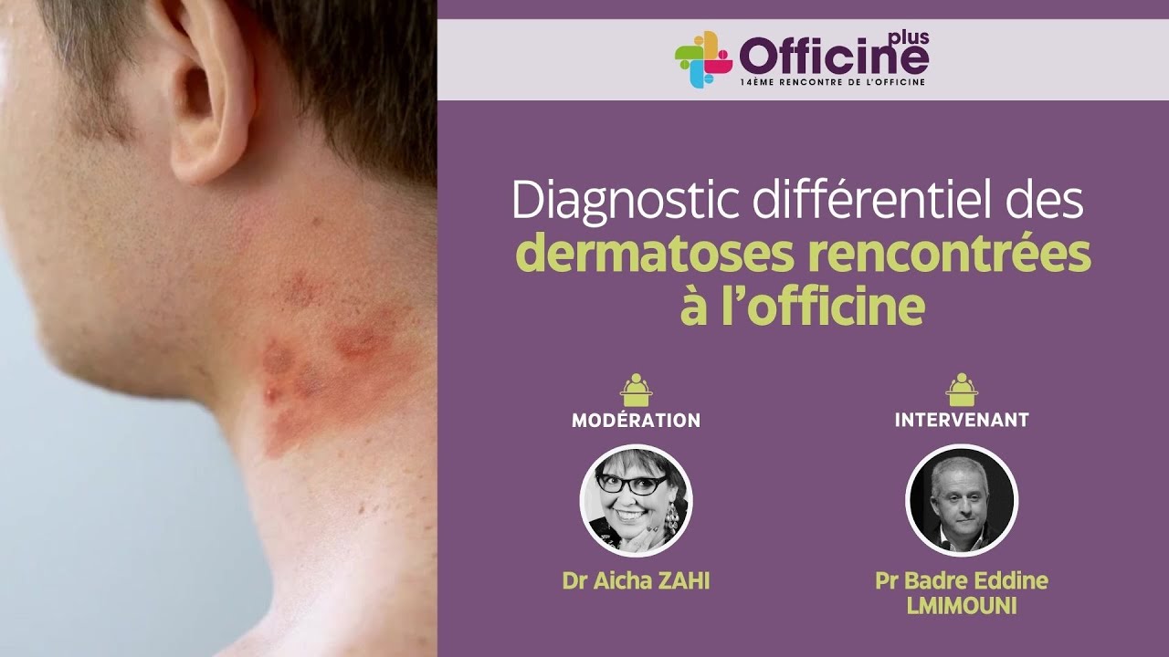 Diagnostic différentiel des dermatoses rencontrées à l’officine ...