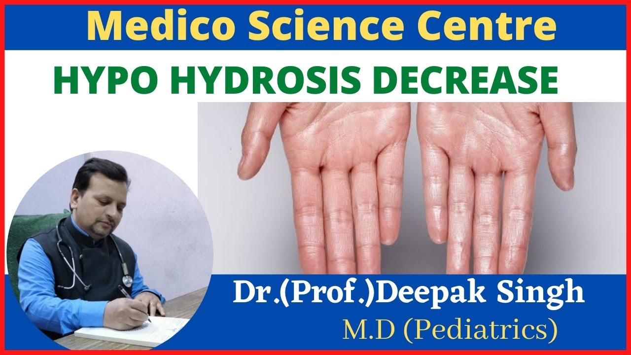 Hypo Hydrosis Decrease Sweating # Deepak PD. Singh - YouTube