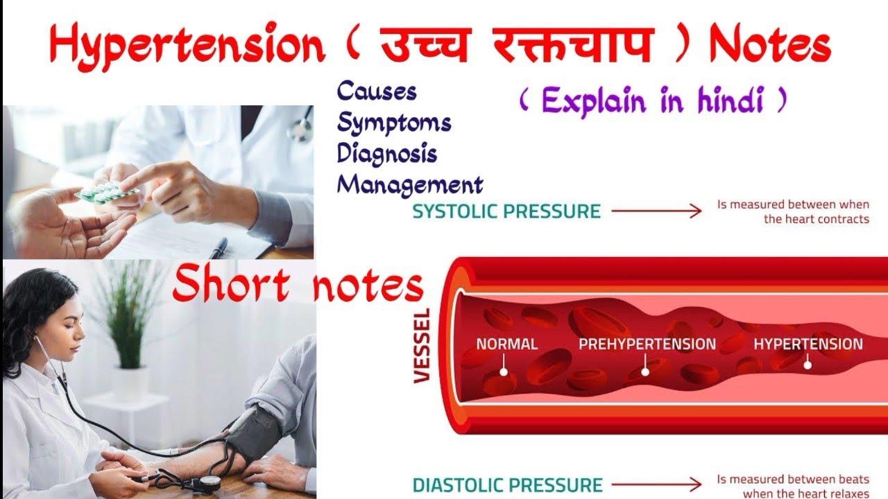 Hypertension short notes | symptoms , diagnosis, management | high BP ...
