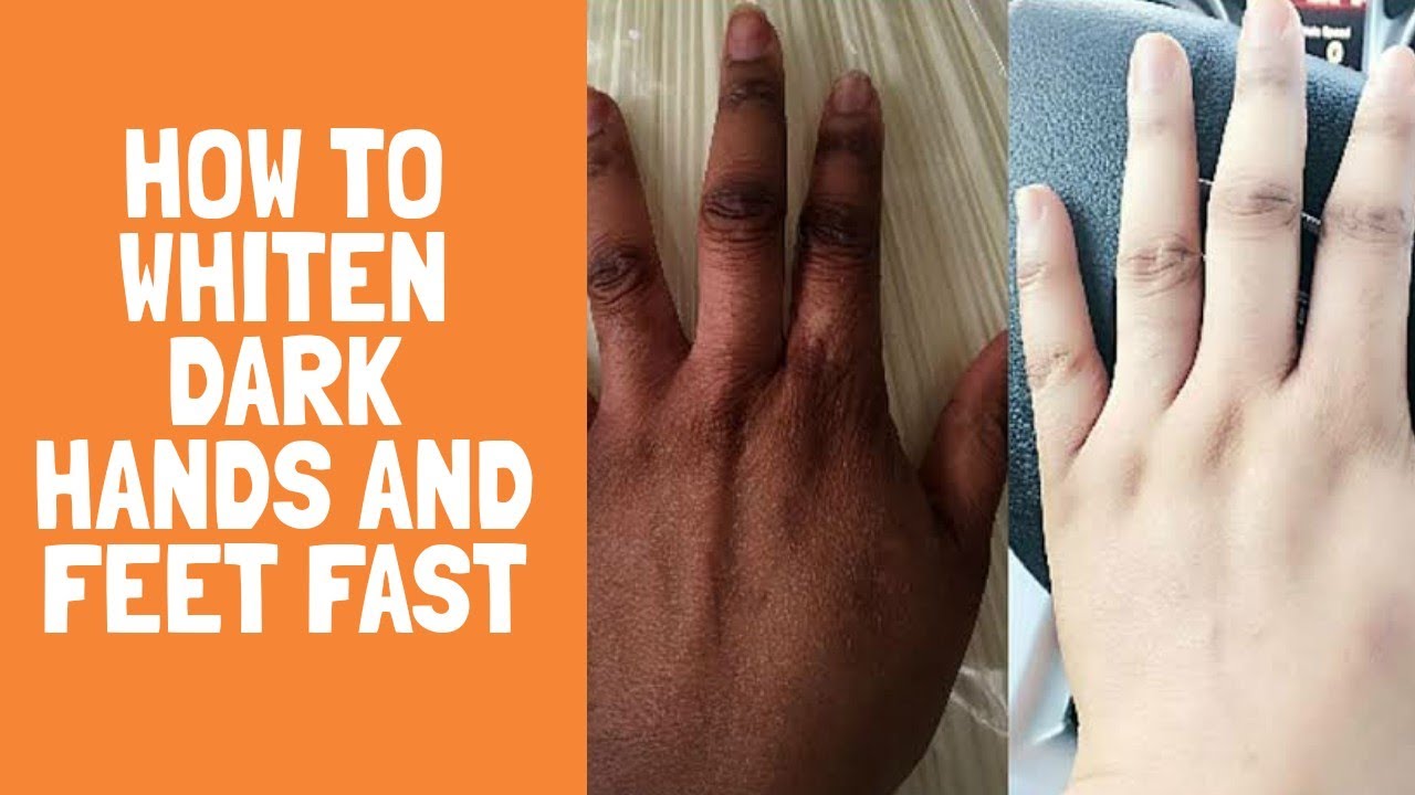 SKIN WHITENING How to whiten dark hands and feet fast - YouTube