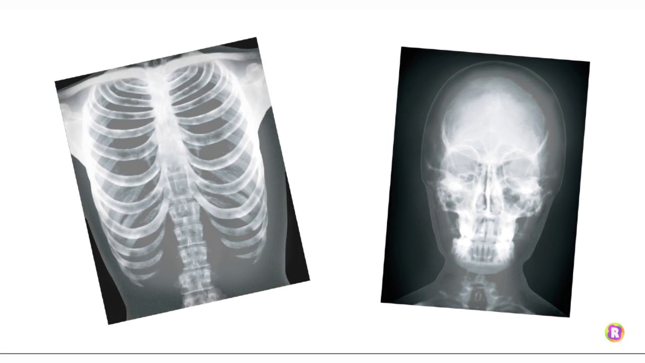 Roylco True to Life Human X Rays - YouTube