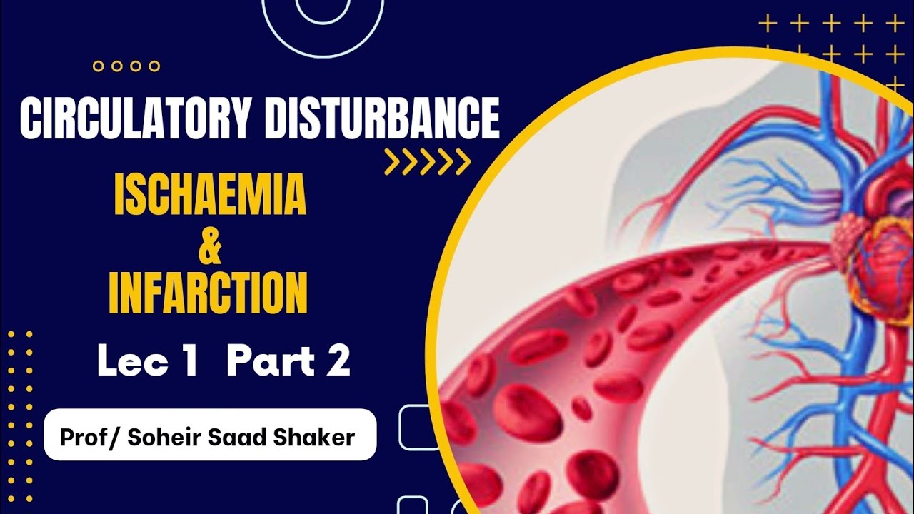 General Pathology 2 ; Lec 1 Part 2 ; Ischaemia & Infarction - YouTube