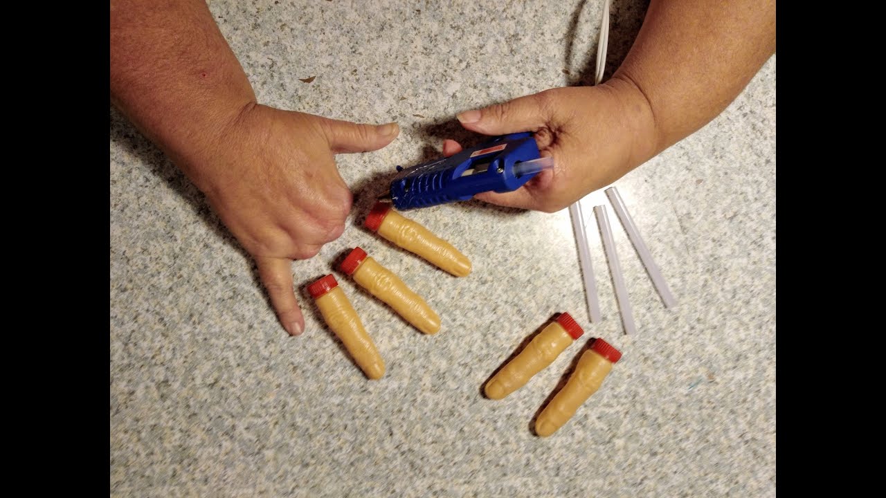 What Happened to my Fingers? * Finger Amputations * Raynaud's - YouTube