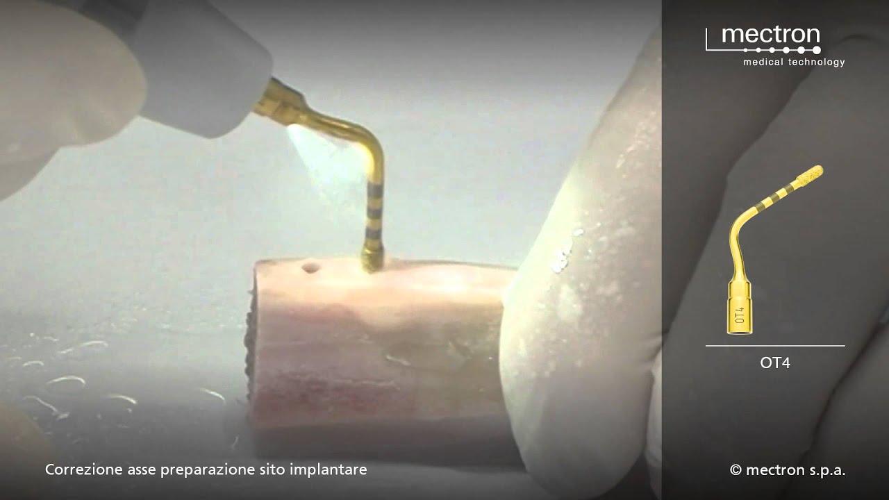 PIEZOSURGERY® tutorial - correction of pilot osteotomy axis - YouTube