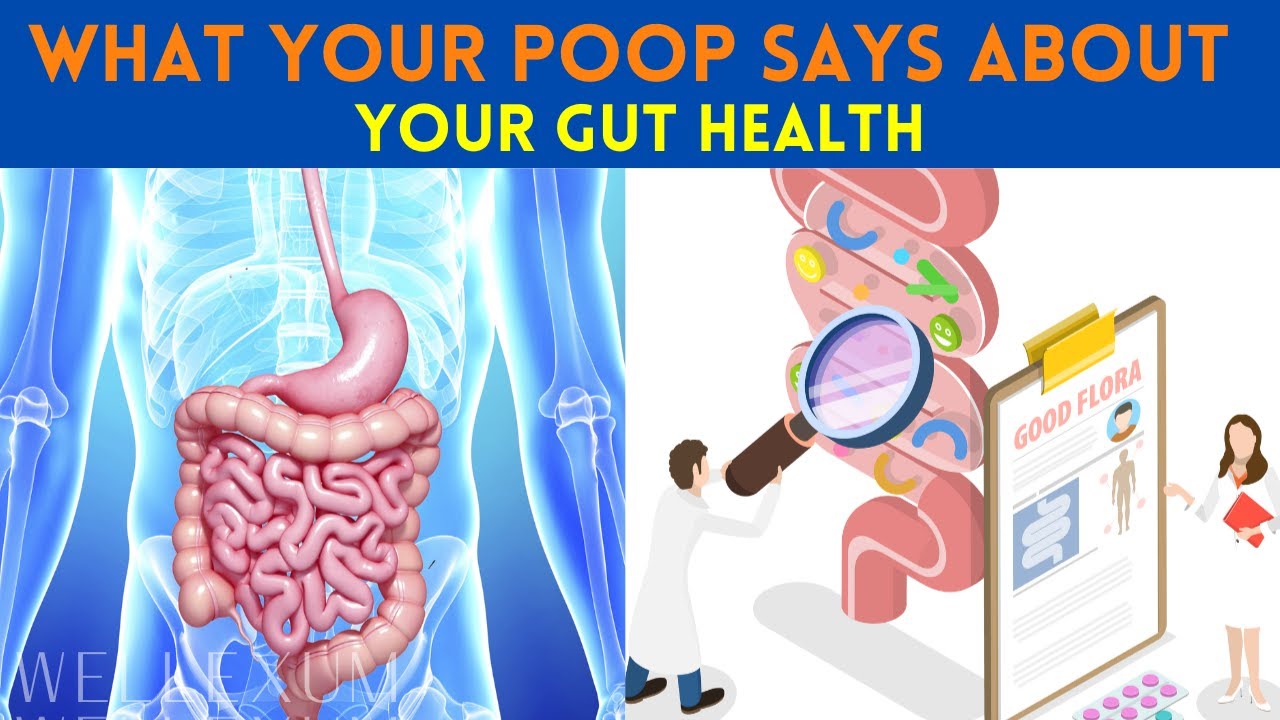What Your Poop Says About Your Gut Health! - YouTube