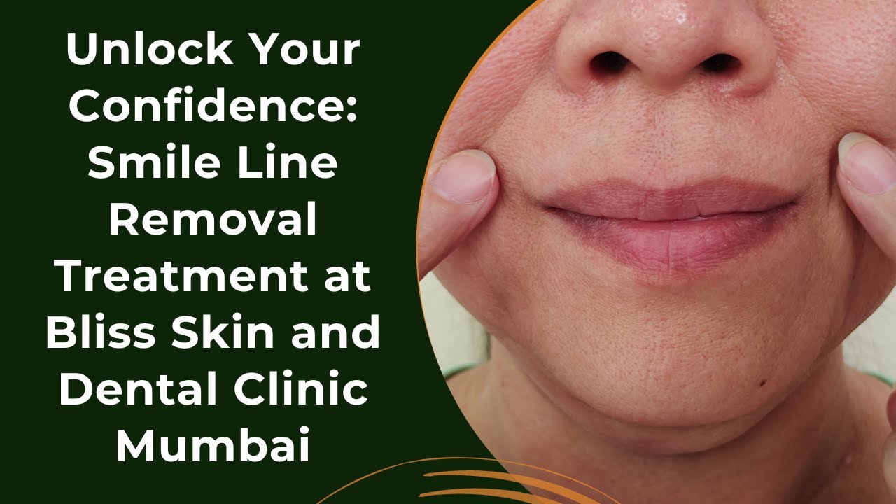 Smile Line Removal Treatment in Bandra,Mumbai - YouTube