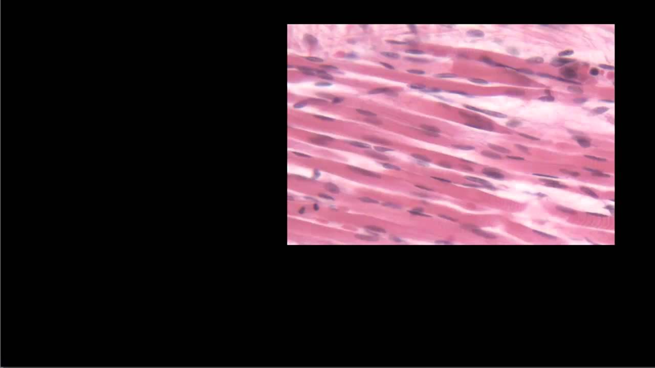 Differentiating Muscle Tissues - YouTube