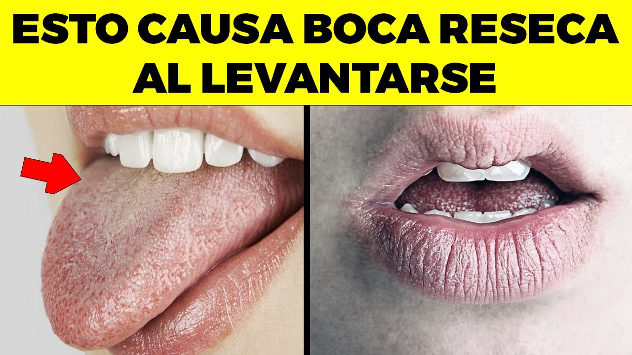 Por Esta Razón Tienes Boca Reseca al Despertar Y Con Que Se Cura - YouTube