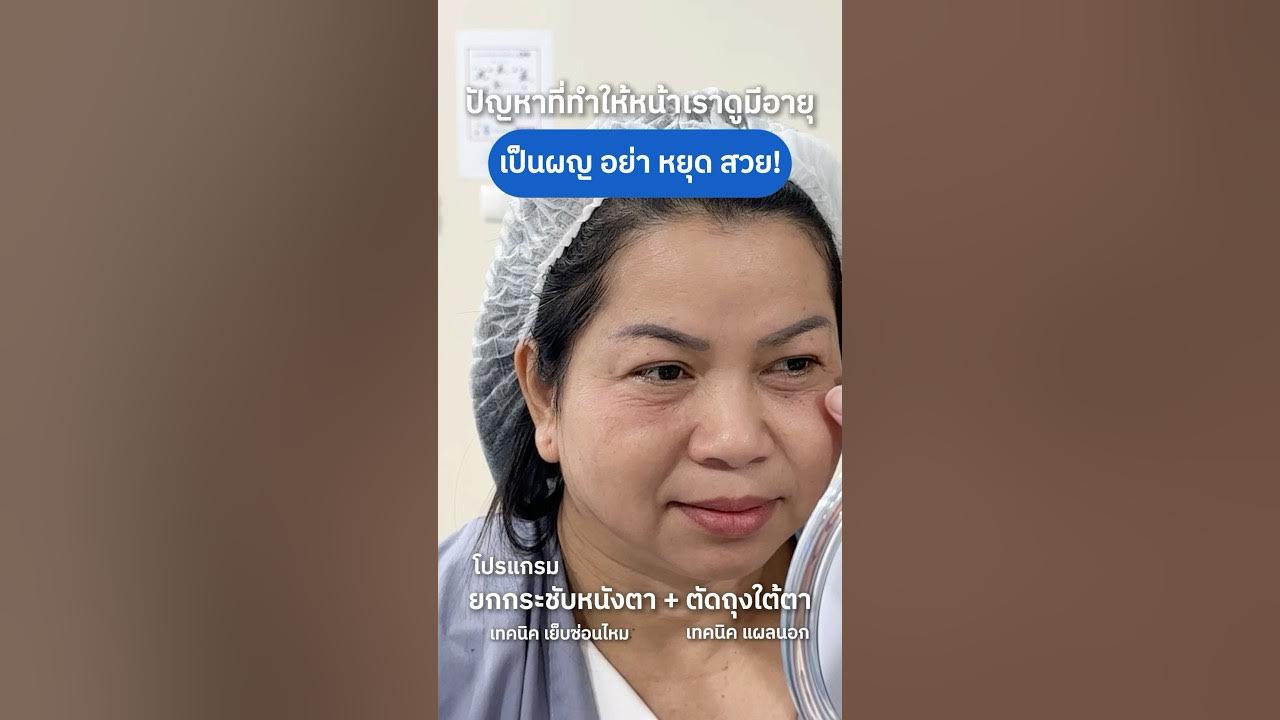 อยากสวย วัยใส ให้ YSC CLINIC ดูแล 💙 #yscclinic #หมอหญิงหมอคิ้ว #หมอหญิงysc #รีวิว #ความงาม - YouTube