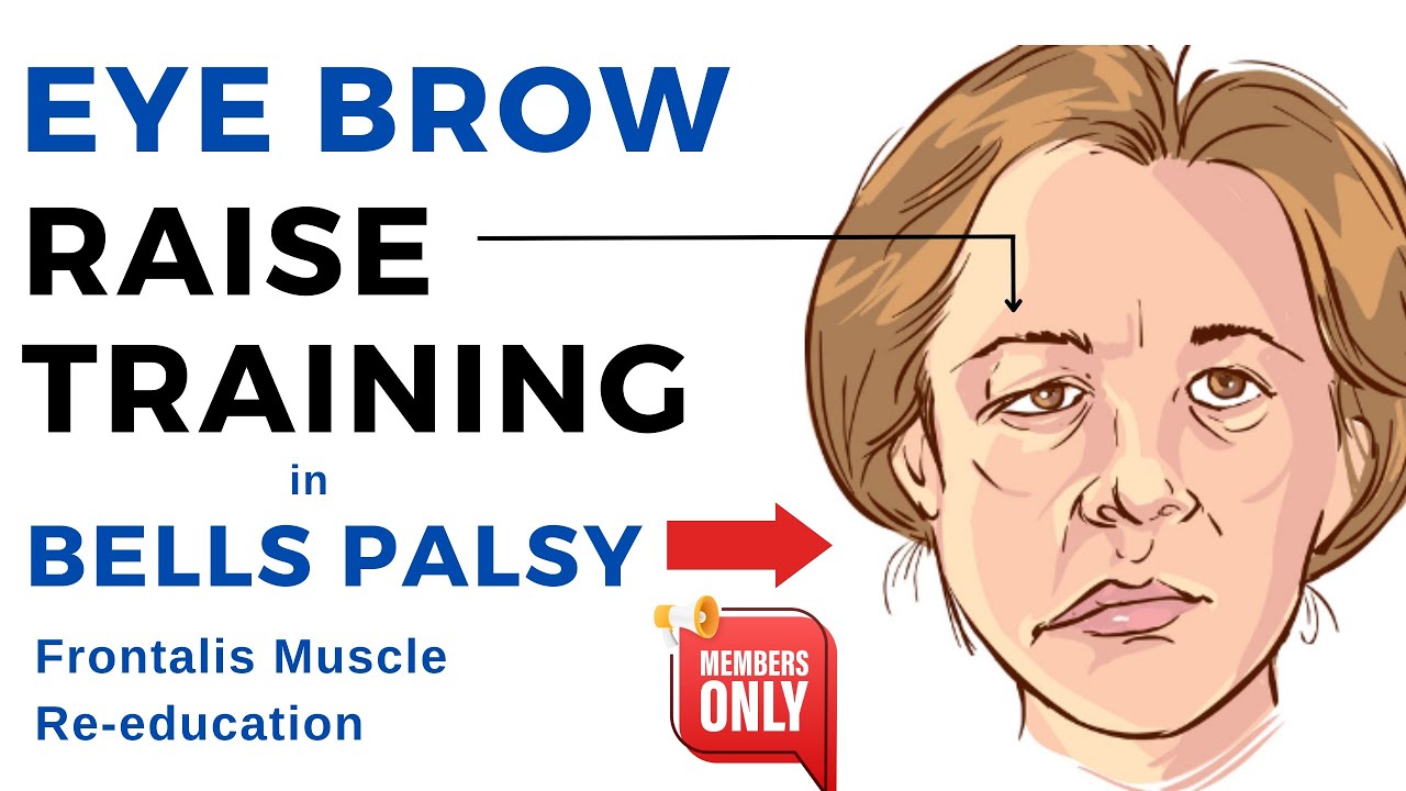 How to regain Eyebrow Movement after Bell's Palsy: Frontalis muscle ...