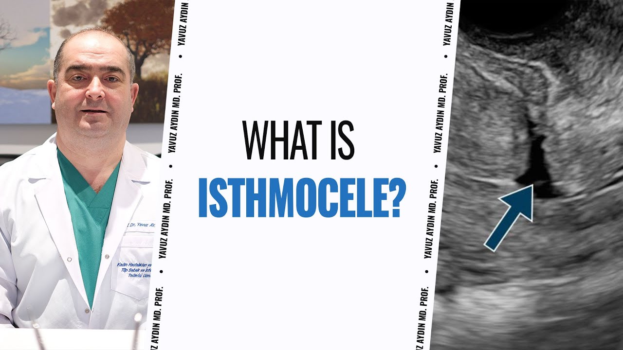 What is Isthmocele? What are its symptoms? - MD. Prof. Yavuz AYDIN ...