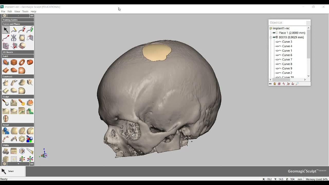 Cranial Implant Design Tutorial Video with Geomagic Sculpt (for MUG500+) - YouTube