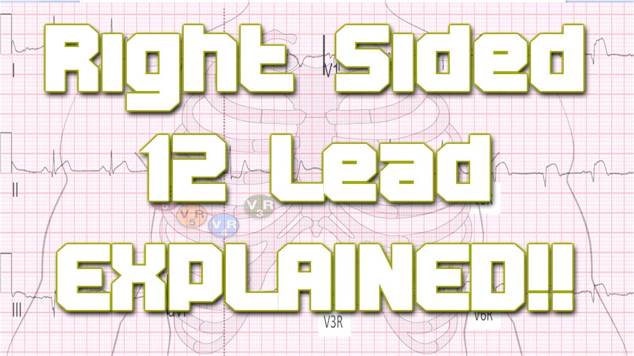 Right Sided 12 Lead Explained | Something In About 5 Minutes | Medic ...