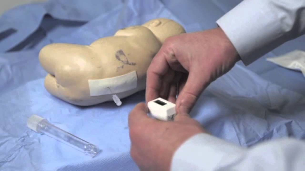 Compass™ Lumbar Puncture Tutorial - YouTube