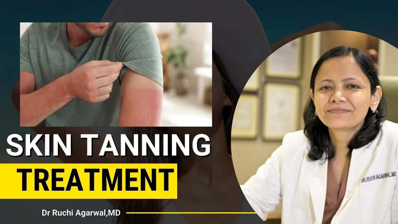 Skin tanning | Skin tan removal laser treatment | Skin tanning ...