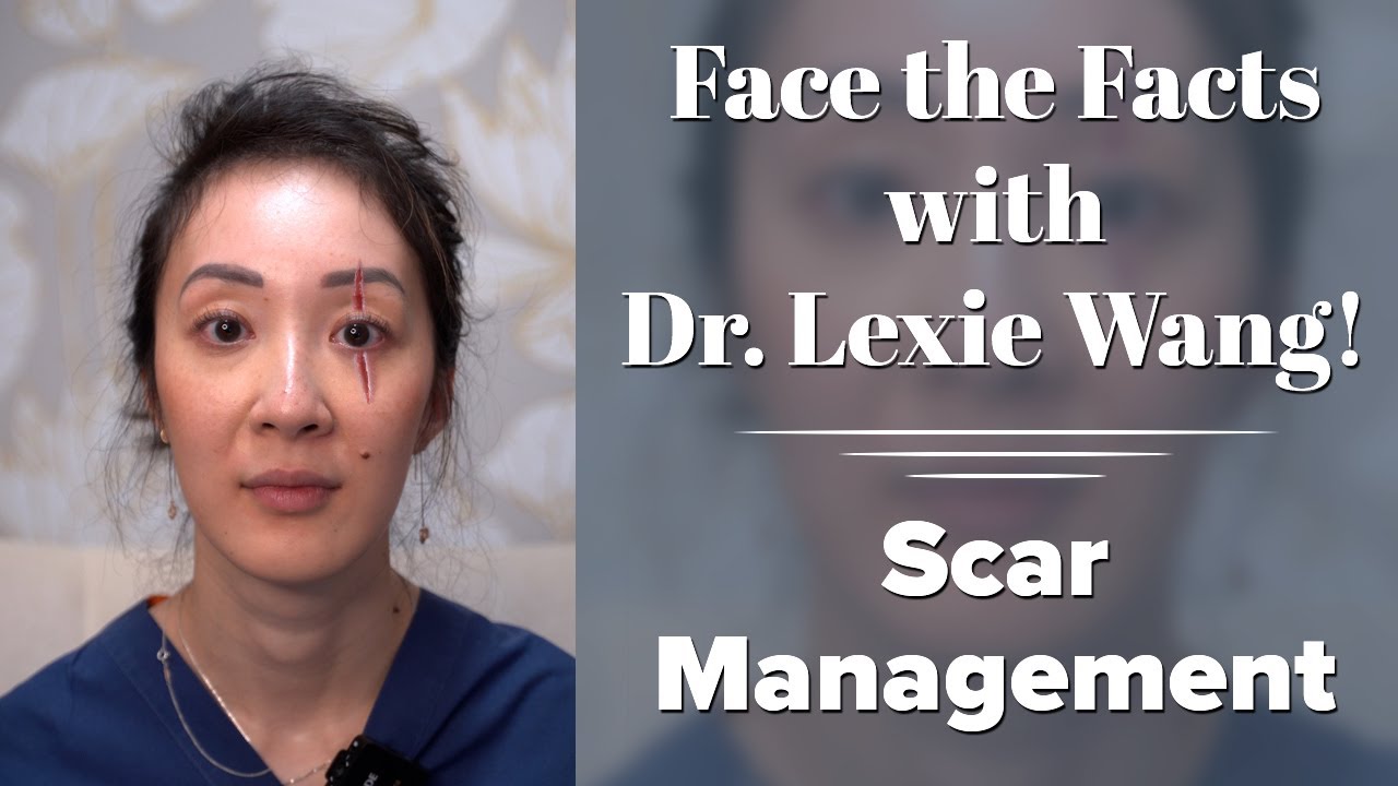 Scar Management - Face the Facts with Dr. Lexie Wang | West End Plastic Surgery - YouTube