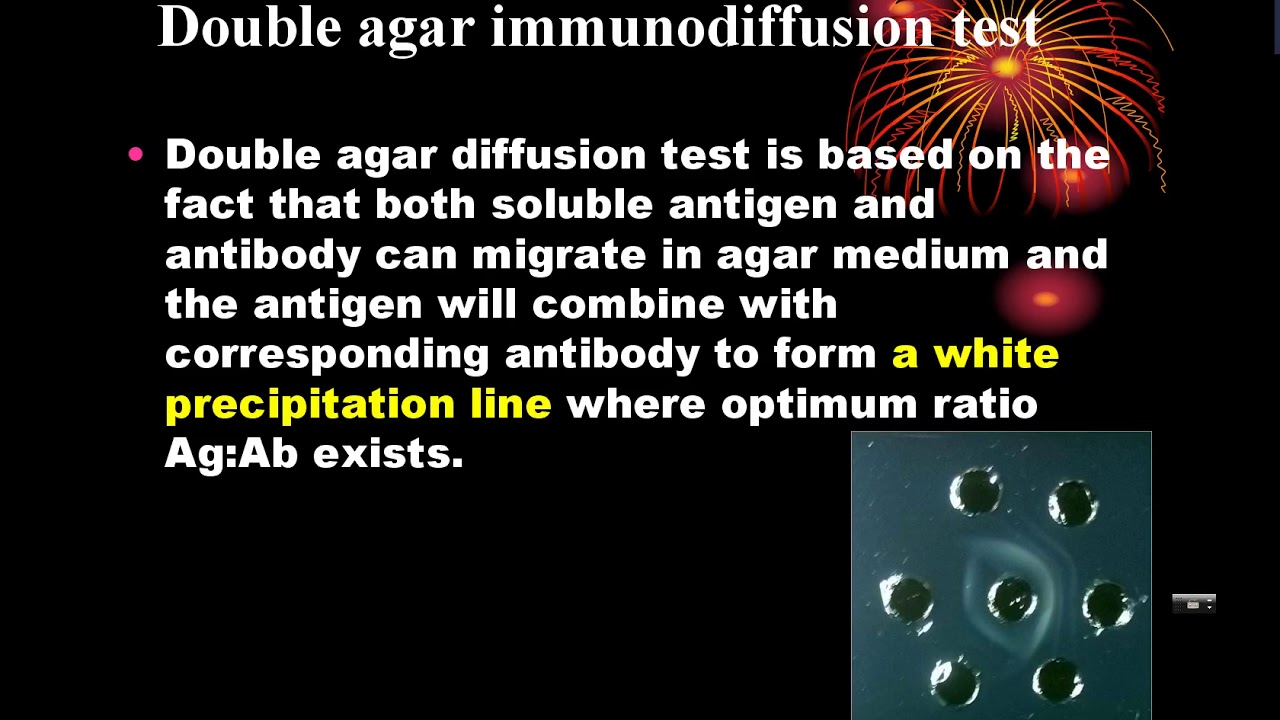 Double Agar Immunodiffusion Test - YouTube