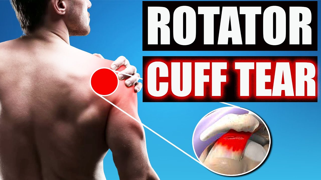 Rotator Cuff Tear Stretching at Asha Vang blog Rotator Cuff Tear Stretching at Asha Vang blog