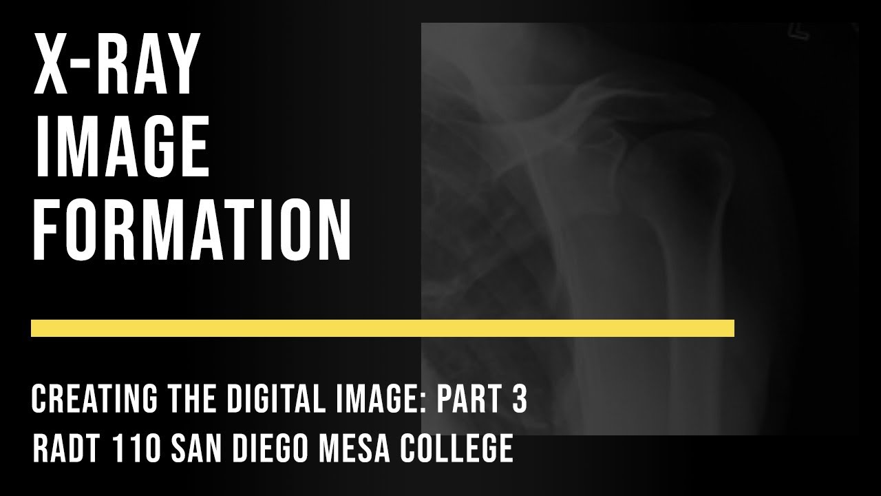 X-ray Image Formation - YouTube